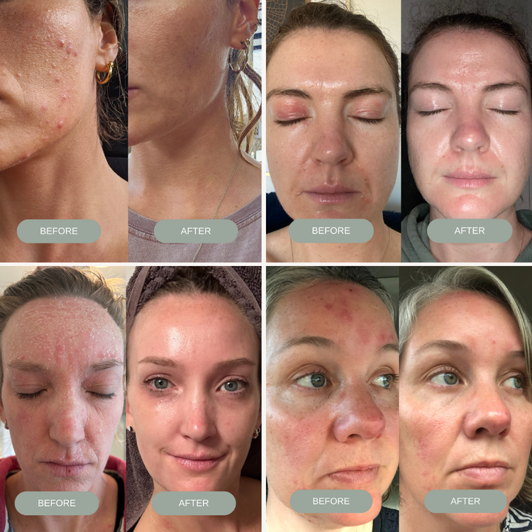 Why Trio Pack – Bescher Beauty