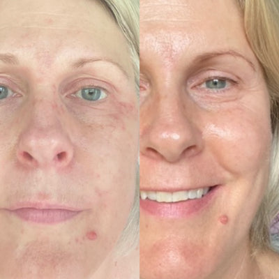 Bescher – Bescher Beauty